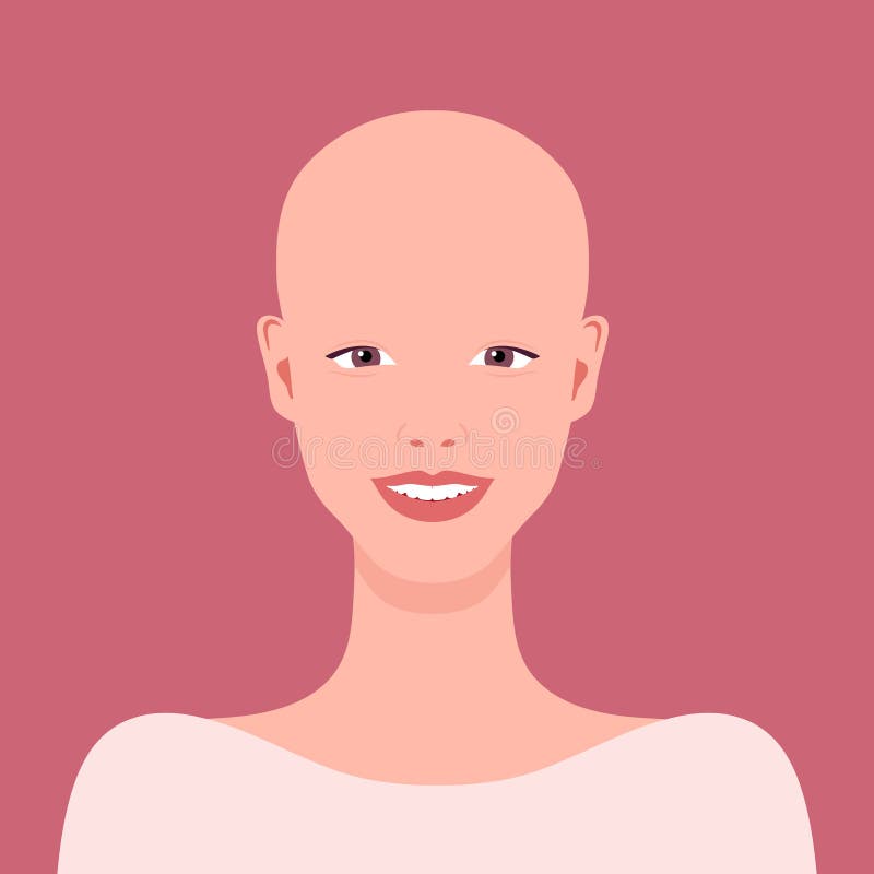 Beautiful Bald Girl Young Smiling Woman With Alopecia Stock