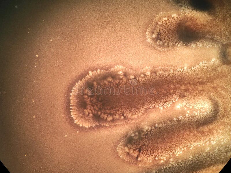 The Beautiful Fractal Pattern of Growth of Bacteria on Nutrient Agar ...