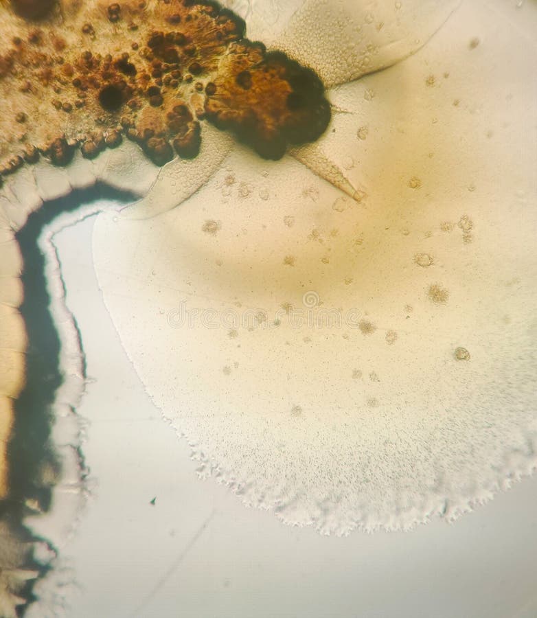 Beautiful Fractal Pattern Growth of a Bacterial Colony Under the ...