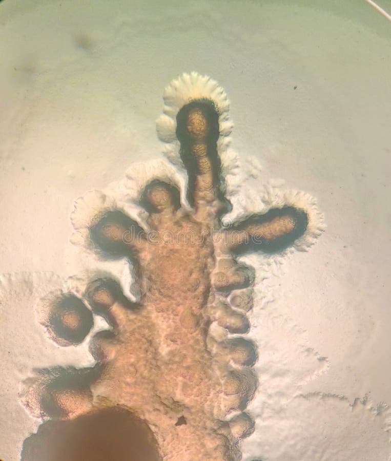 Beautiful Baciullus Genus Bacterial Colonies Under the Microscope Stock ...