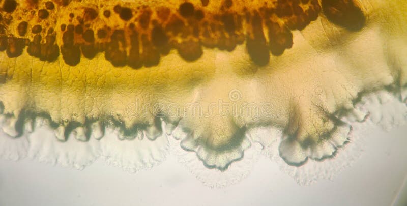Beautiful Fractal Pattern Growth of a Bacterial Colony Under the ...