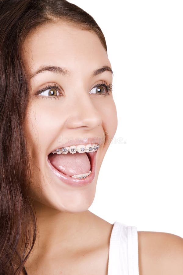 Beautiful Girl With Braces Stock Image Image Of Smiling 16571945