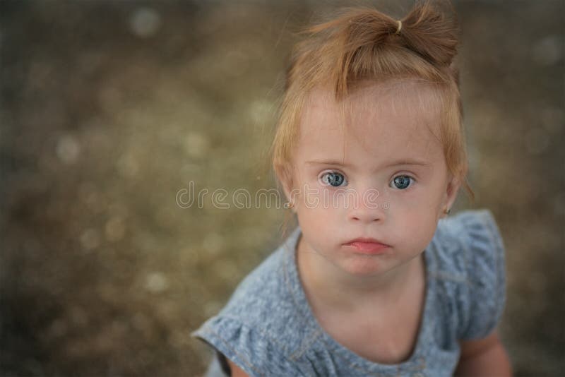 Beautiful Girl with Down Syndrome on the Beach Stock Image - Image of ...