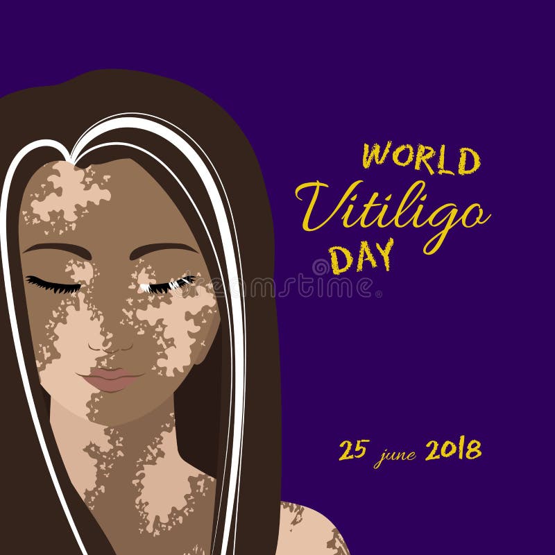 World Vitiligo Day Poster Stock Vector Illustration Of International