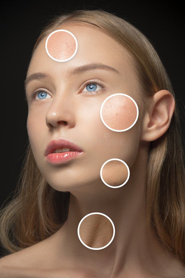 Beautiful Girl with Various Types of Skin Stock Photo - Image of oily ...
