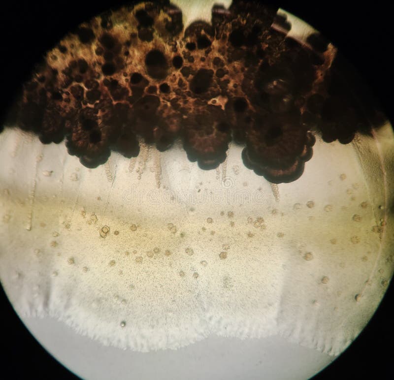 Beautiful Growth of a Bacterial Colony Under the Microscope Stock Photo ...