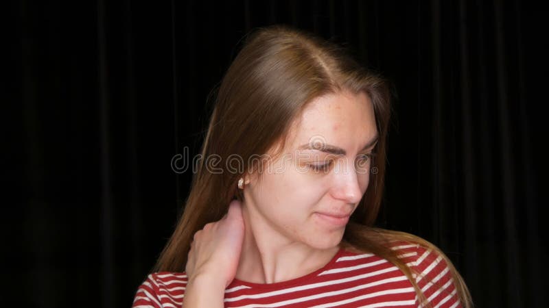 Beautiful Long-haired Girl with Problem Skin Poses in Front of Camera ...