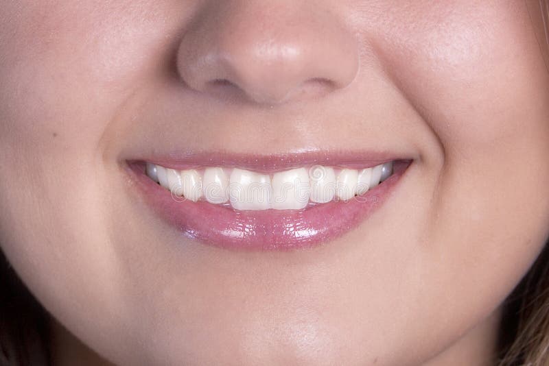 Beautiful Smile with Perfect Teeth Stock Image - Image of bleaching ...