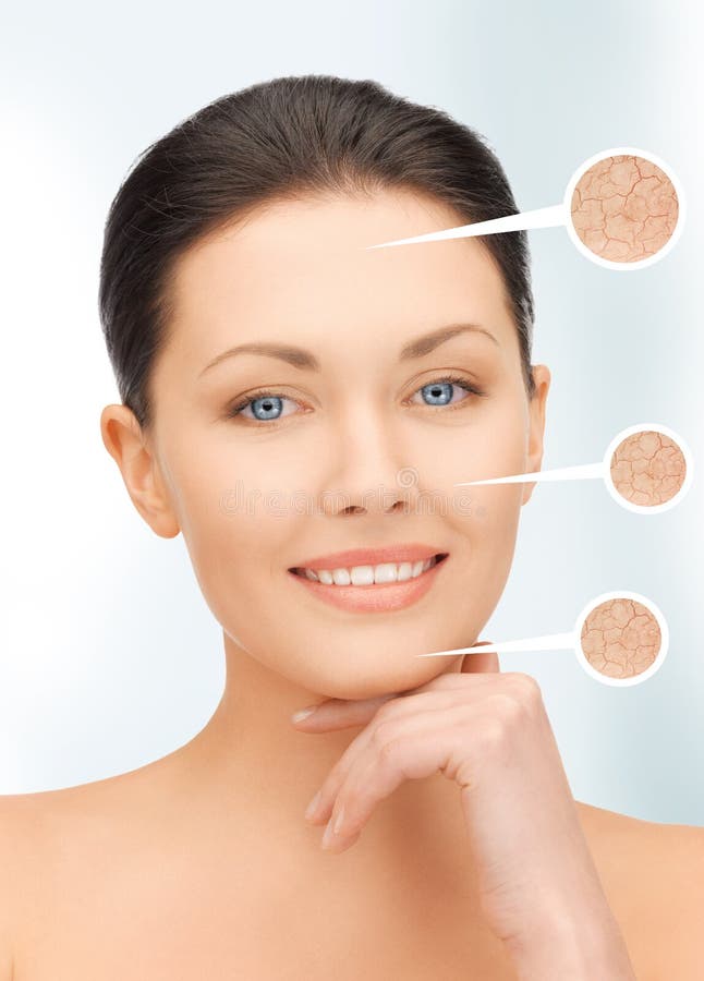 Zoom Circle Shows Dry Facial Skin before Moistening. Stock Image ...