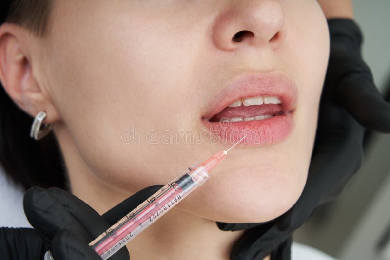 Beautiful Woman Gets an Injection in Her Lips Stock Image - Image of ...