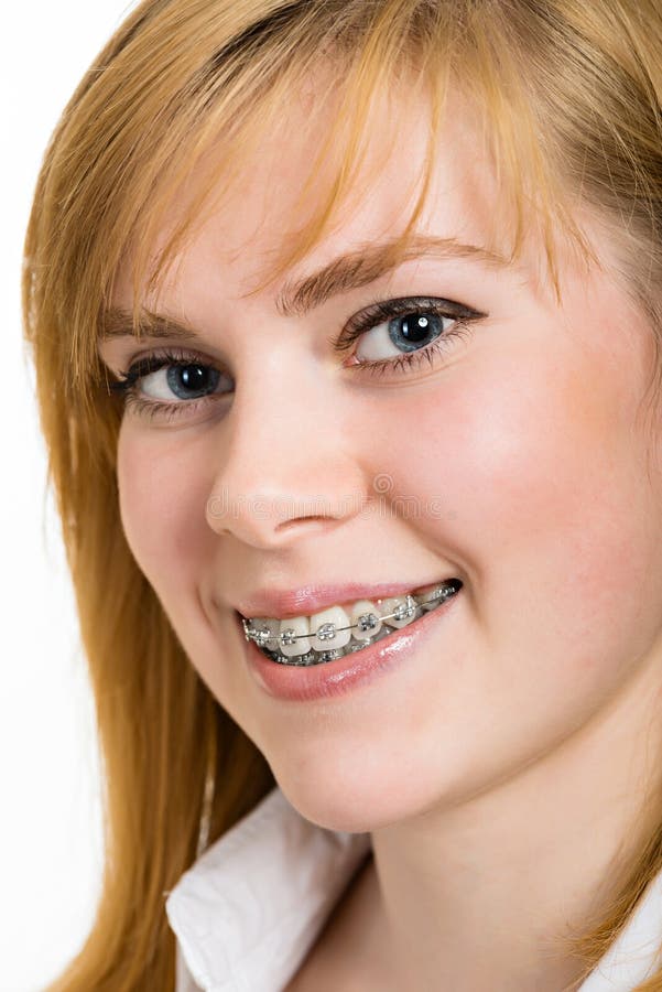Teen girl with brackets stock photo. Image of laugh, female - 24734510