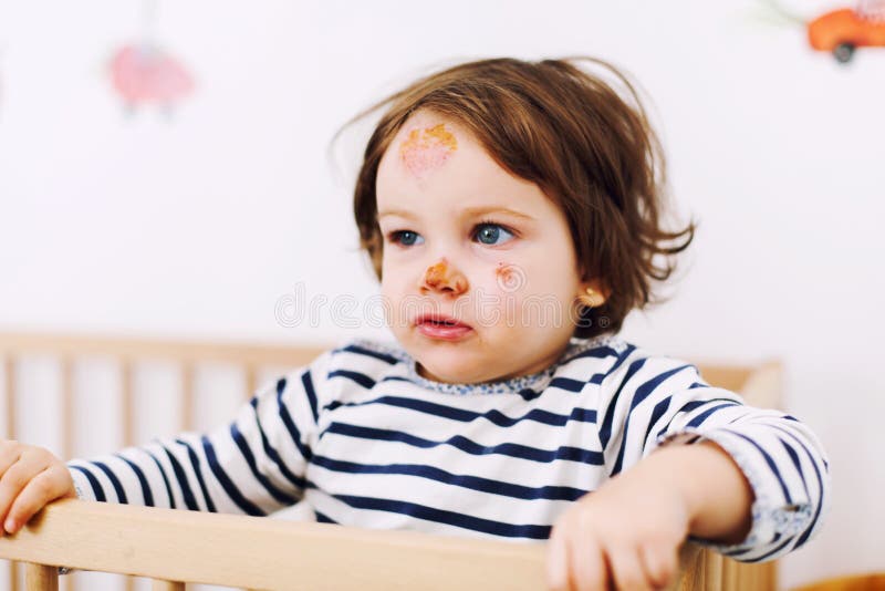 Bebé con las contusiones imagen de archivo. Imagen de triste - 44372671