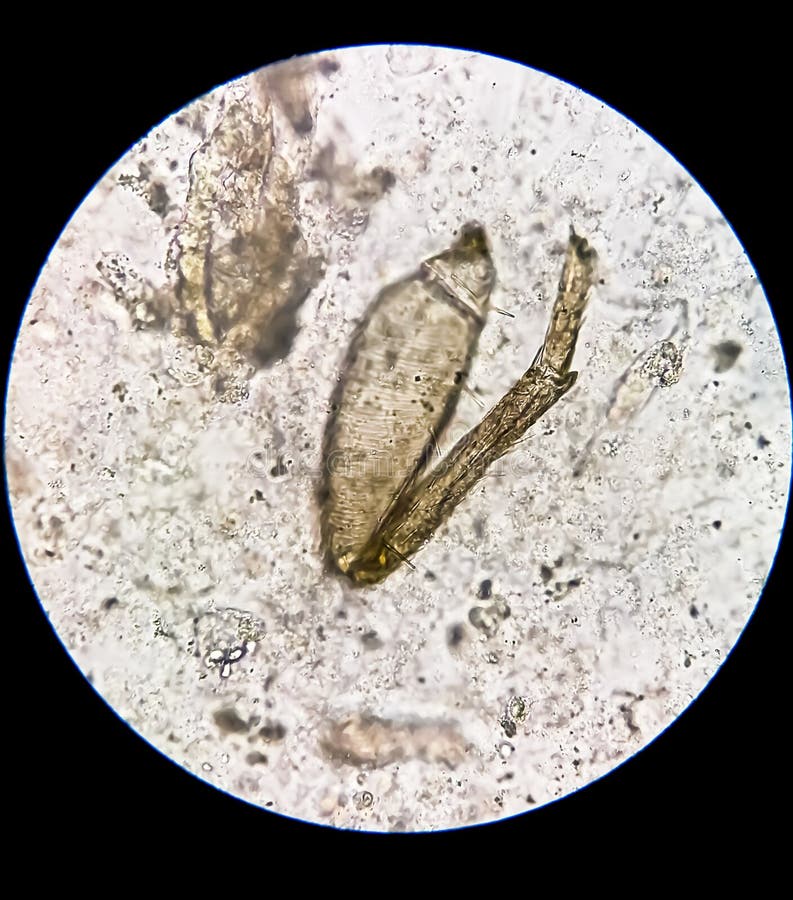 Honey Under Microscope Stock Photos - Free & Royalty-Free Stock Photos ...