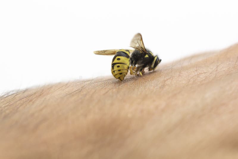 Bee stinging in human hand stock photo. Image of insect - 149734284