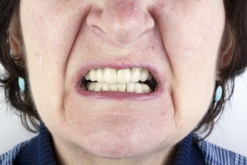 De Tanden Van Een Bejaarde Worden Bedorven Door Bederf, Tandsteen En Po ... De Tanden Van Een Bejaarde Worden Bedorven Door Bederf, Tandsteen En Po ...