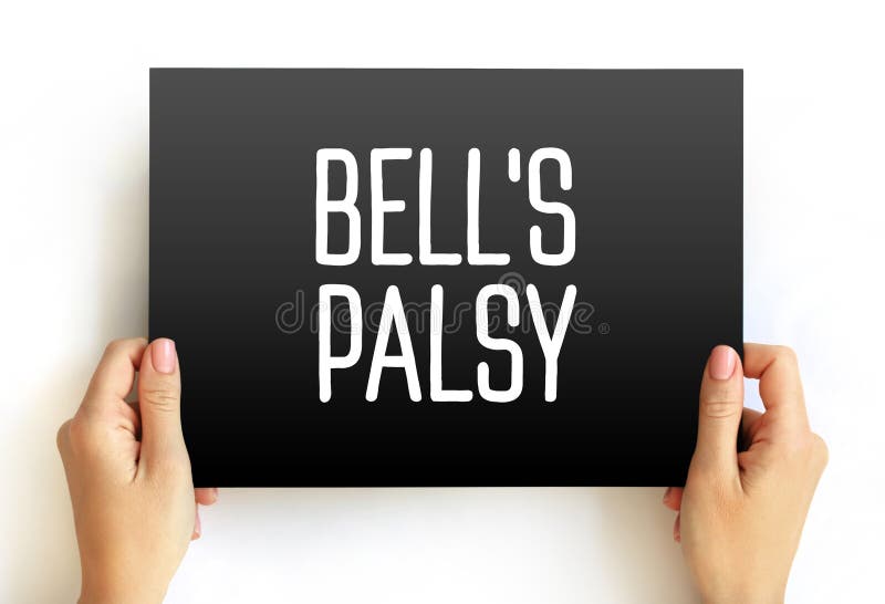 Bell S Palsy - Neurological Disorder that Causes Paralysis or Weakness ...