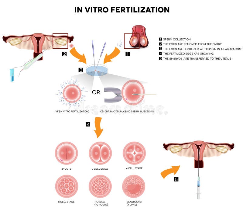 Bemesting in vitro vector illustratie. Illustration of biotechnologie ...