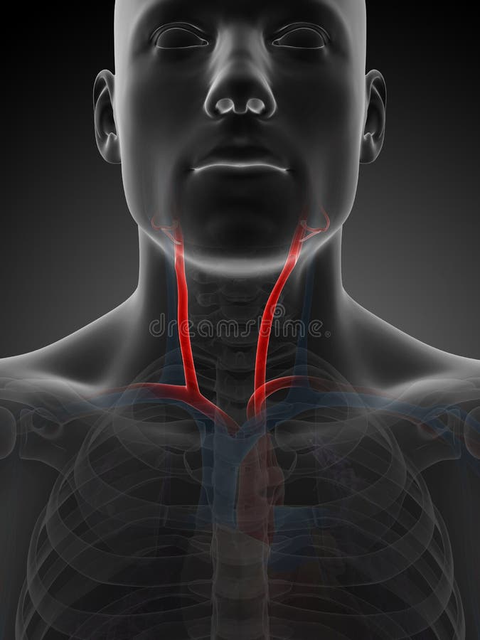 Benadrukte Slagader Van De Halsslagader Stock Illustratie ...