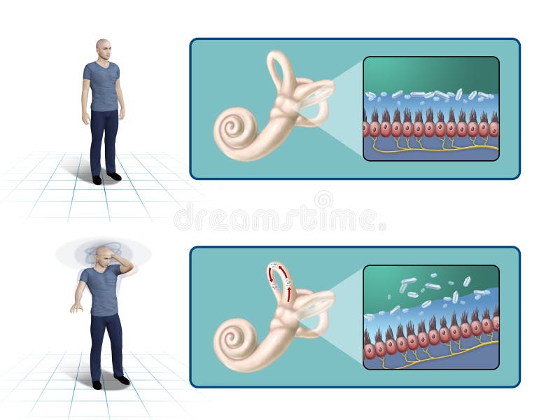 Dizzy Render Stock Illustrations – 605 Dizzy Render Stock Illustrations ...