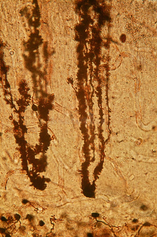 Bergmann Glia. Golgi Silver Chromate Stock Image - Image of cerebellar ...