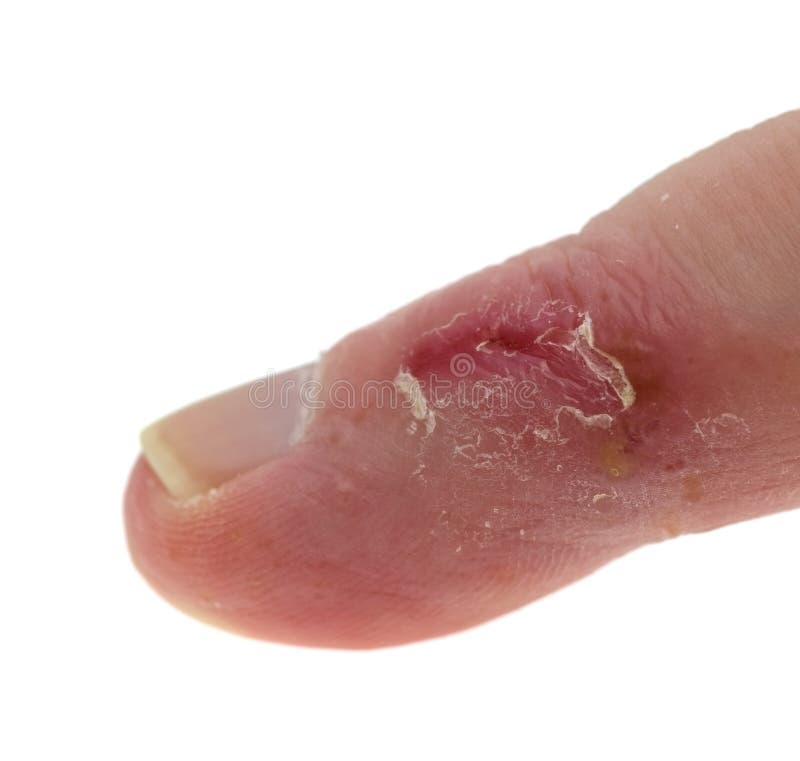 Besmette Vinger Op Een Witte Achtergrond Stock Afbeelding - Image of ...