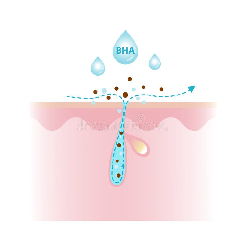 Beta Hydroxy Acids Characteristics Vector Illustration Isolated on ...