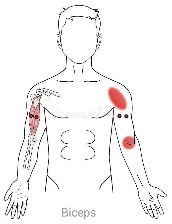 Over Worked Biceps Can Caise Elbow Pain and Shoulder Pain Stock ...