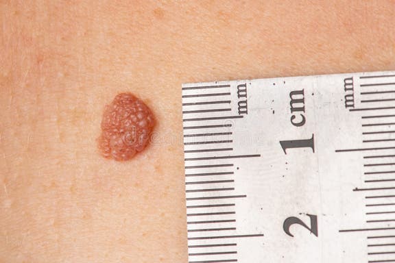 126 Mm Ruler Stock Photos - Free & Royalty-Free Stock Photos from ...