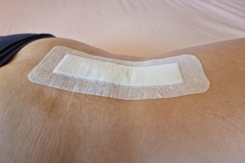 Big Plaster on Men`s Back after Spine Operation - Herniated Discs ...