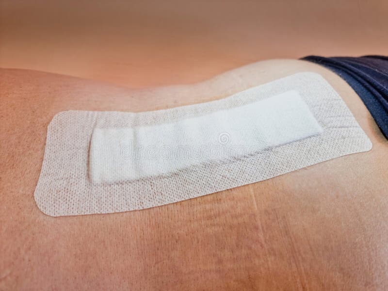 Big Plaster on Men& X27;s Back after Spine Operation - Herniated Discs ...