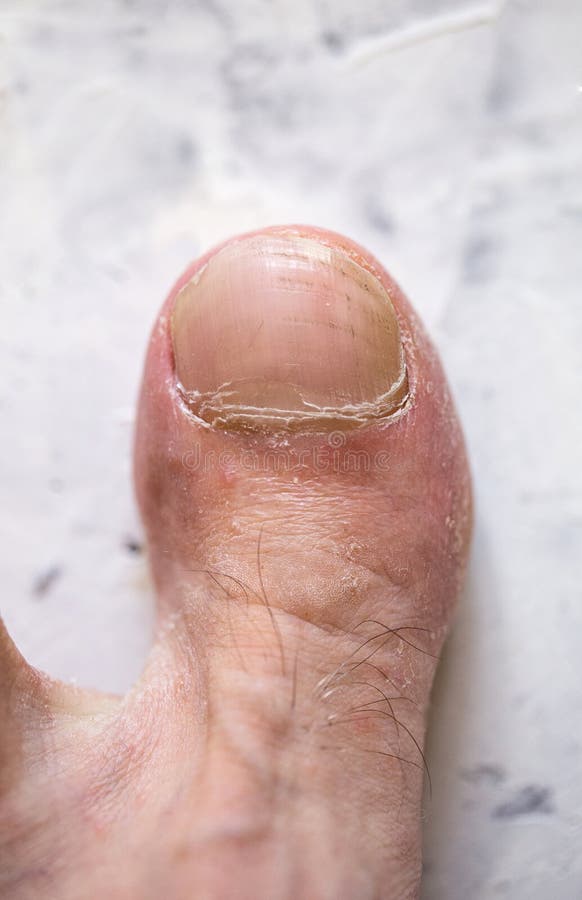 Big toe of a man close up stock photo. Image of person - 220953330
