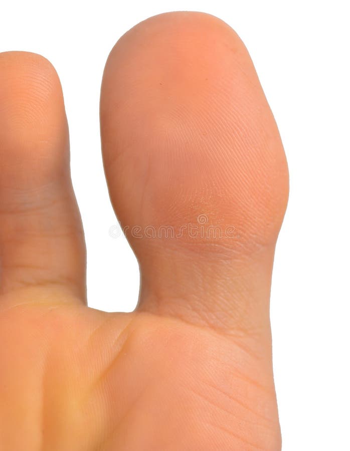 Big toe stock photo. Image of isolated, toenail, white - 24791602