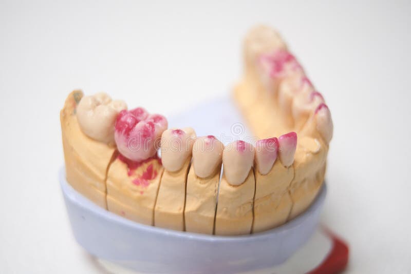 Tandprotes materielbilder - royalty för nedladdning 18,344 frigör foto