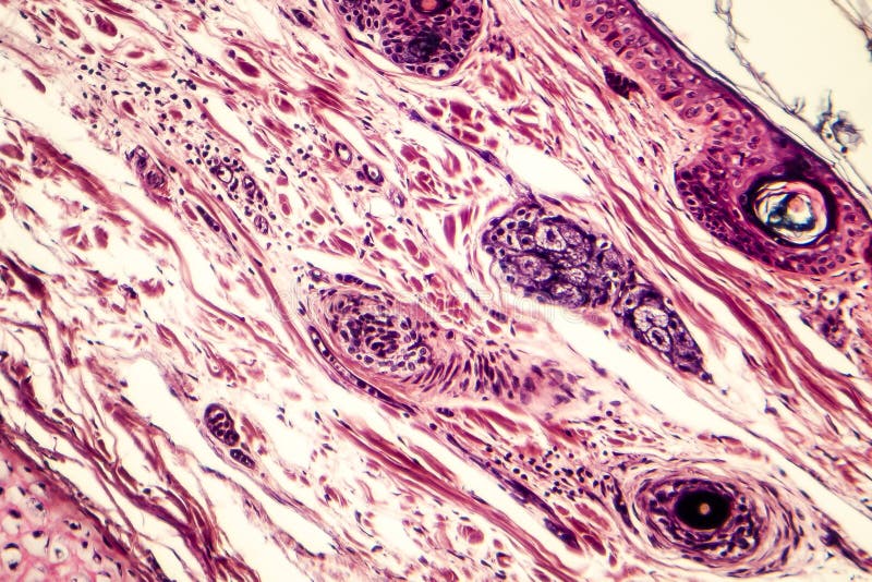 Bindegewebe, Heller Mikrograph Stockfoto - Bild von gewebe ...