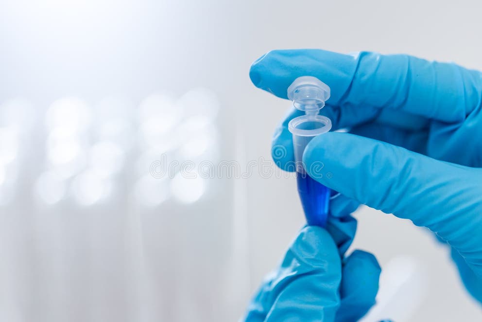 Biochemical Analysis and Chemical Analysis in Lab. Stock Photo - Image ...