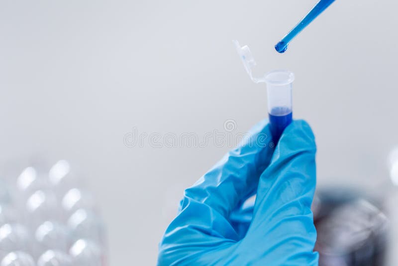Biochemical Analysis and Chemical Analysis in Lab. Stock Photo - Image ...