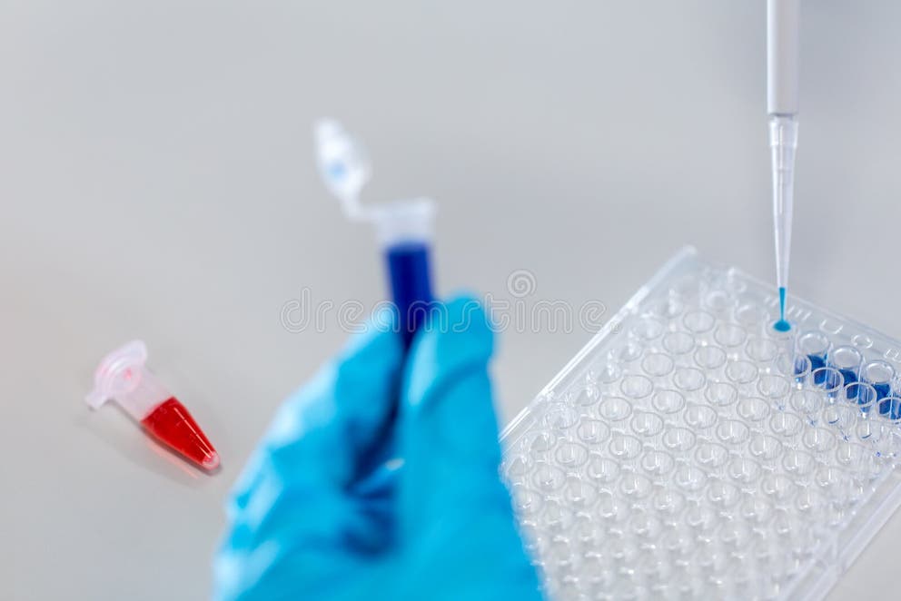 Biochemical Analysis and Chemical Analysis in Lab. Stock Photo - Image ...