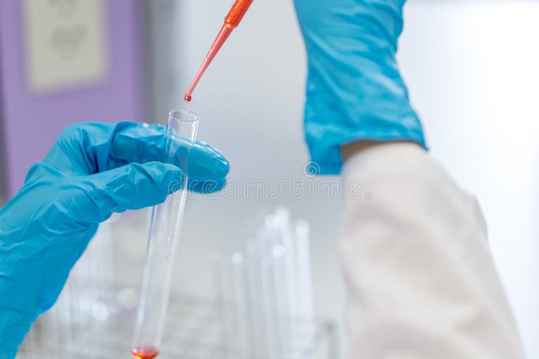 Biochemical Analysis and Chemical Analysis in Lab. Stock Image - Image ...