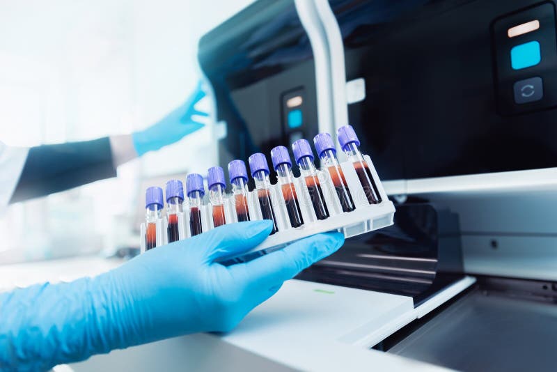 Biochemical Analyzer Blood Tests on Modern Equipment of Laboratories ...