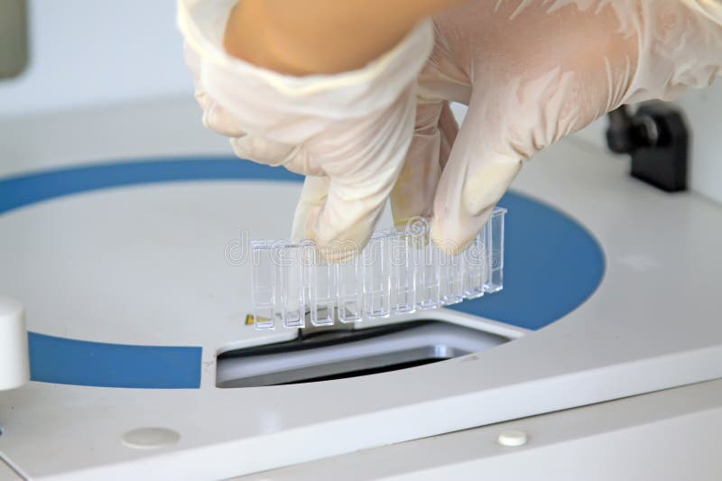 Biochemical Analyzer Test in Centers for Disease Control Stock Photo ...