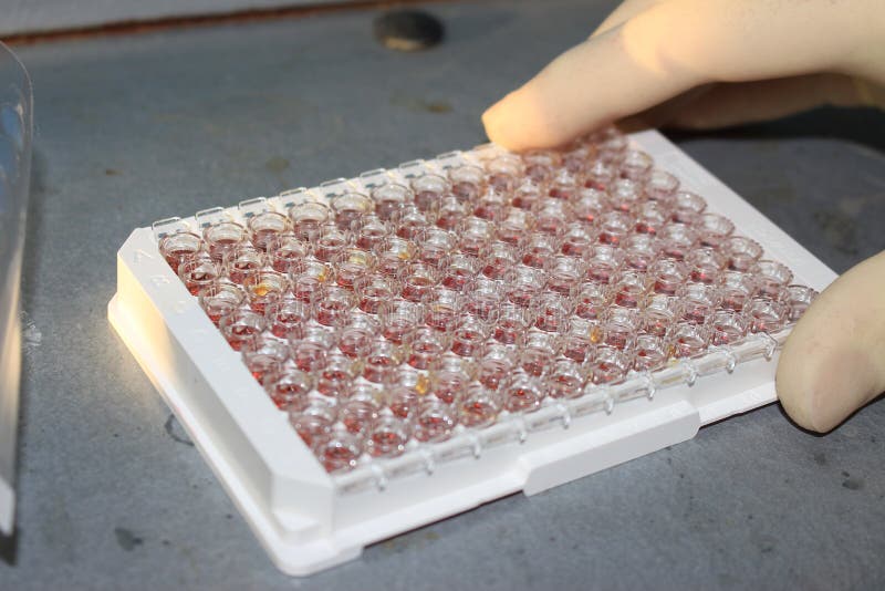 286 Biochemical Tests Photos - Free & Royalty-Free Stock Photos from ...