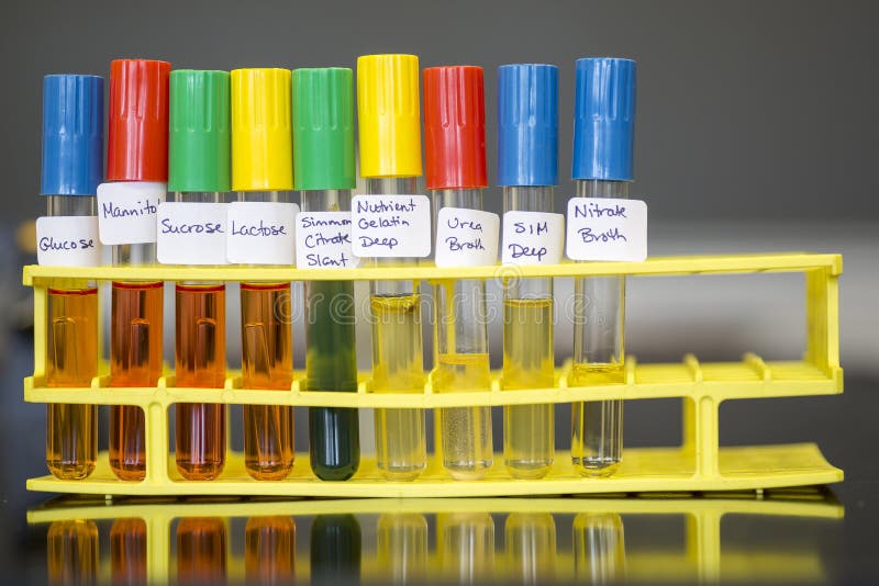 Biochemical Tests stock image. Image of inspection, broth - 164964243 Biochemical Tests stock image. Image of inspection, broth - 164964243