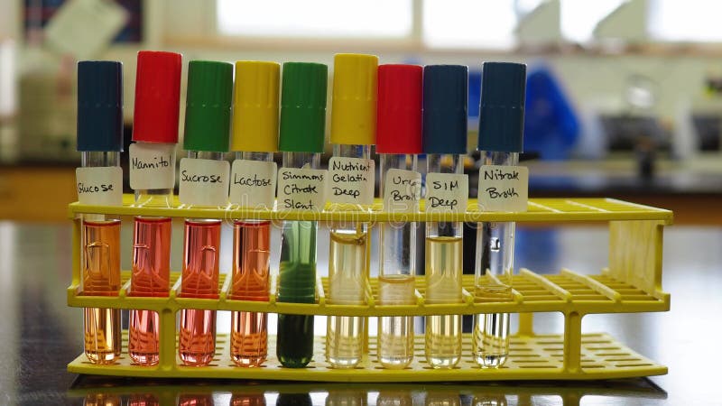 Microbiology Biochemistry Test Stock Video - Video of bacterium, food ...