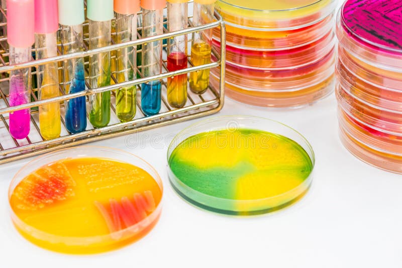 Biochemie-Tests Und Nährbodenplatte Stockbild - Bild von zelle, labor ...