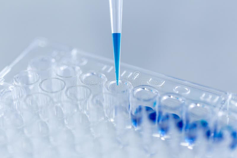 Biochemische Analyse En Chemische Analyse in Laboratorium Stock ...