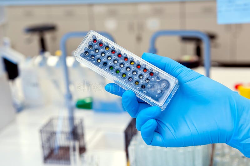 Biochemische Test in Microbiologisch Laboratorium Mengen Stock ...