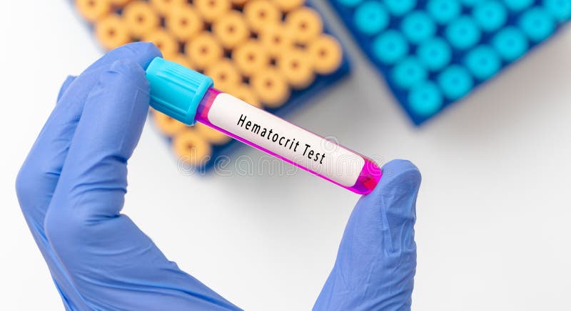 Biochemistry Blood Sample for Hematocrit, HTC, MCV Test Stock Photo ...