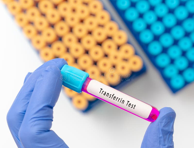 Biochemistry Blood Sample for Transferrin Test Stock Photo - Image of ...