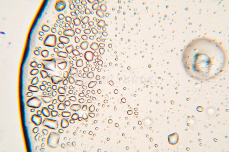 Biological Fluid at a Crime Scene Under a Microscope As Evidence of a ...