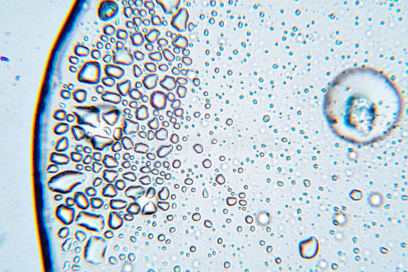 Biological Fluid at a Crime Scene Under a Microscope As Evidence of a ...